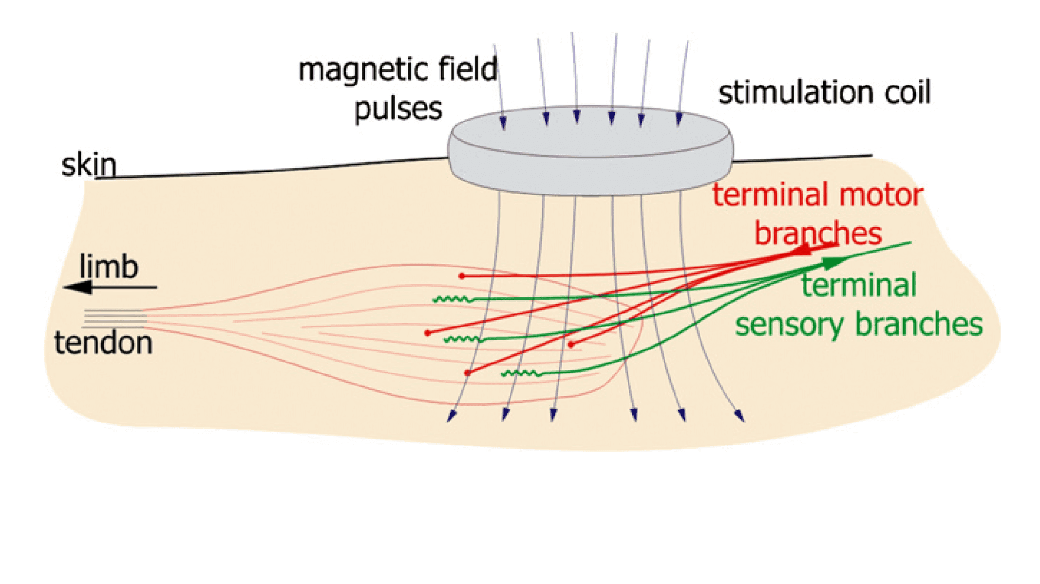 Magnetic Peripheral Nerve Stimulation (mPNS) Thera | Magwise Medical Center
